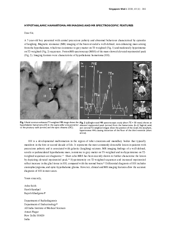 (PDF) Hypothalamic hamartoma: MR imaging and MR spectroscopic features