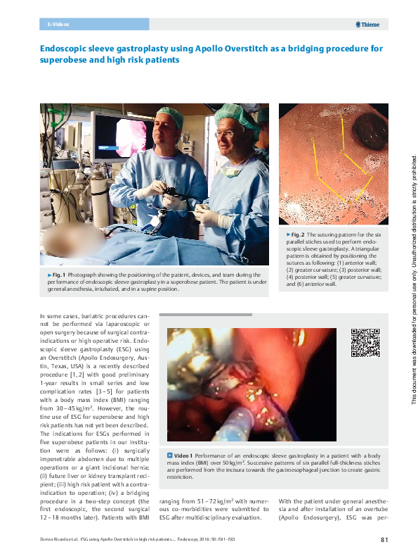 (PDF) Endoscopic sleeve gastroplasty using Apollo Overstitch as a bridging procedure for ...
