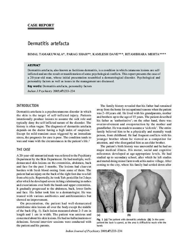 (PDF) Dermatitis artefacta