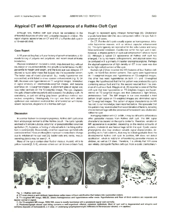 (PDF) Atypical CT and MR appearance of a Rathke cleft cyst