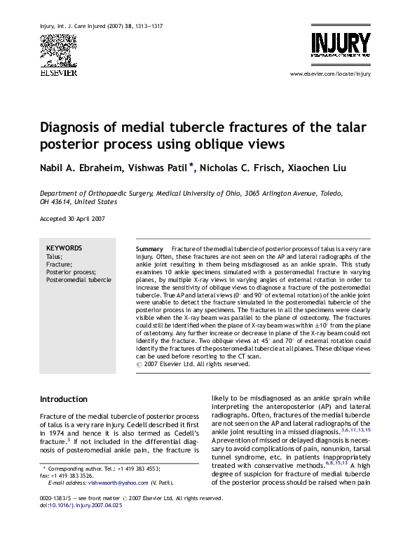 (PDF) Diagnosis of medial tubercle fractures of the talar posterior ...