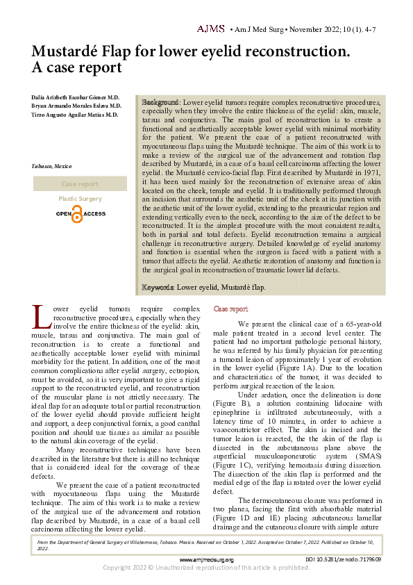 (PDF) Mustardé Flap for lower eyelid reconstruction. A case report