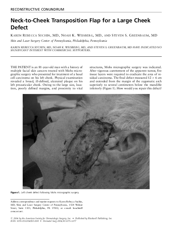 (PDF) Neck-to-Cheek Transposition Flap for a Large Cheek Defect