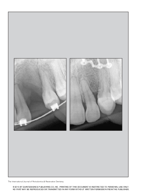 (PDF) Establishing and Maintaining Osseointegration Within the ...