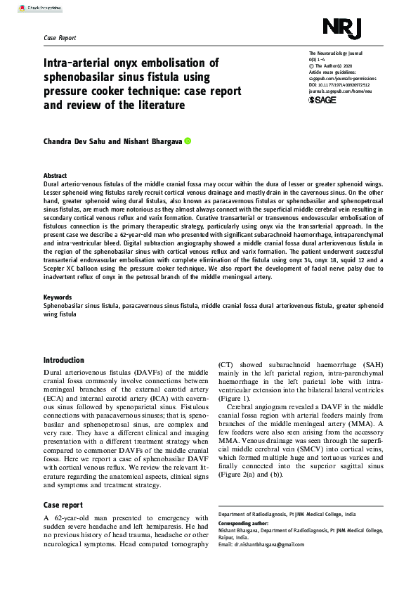 (PDF) Intra-arterial onyx embolisation of sphenobasilar sinus fistula ...