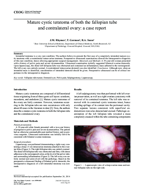 (PDF) Mature cystic teratoma of both the fallopian tube and ...