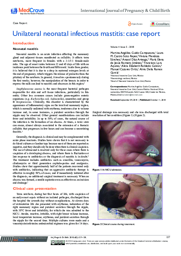 (PDF) Unilateral neonatal infectious mastitis: case report