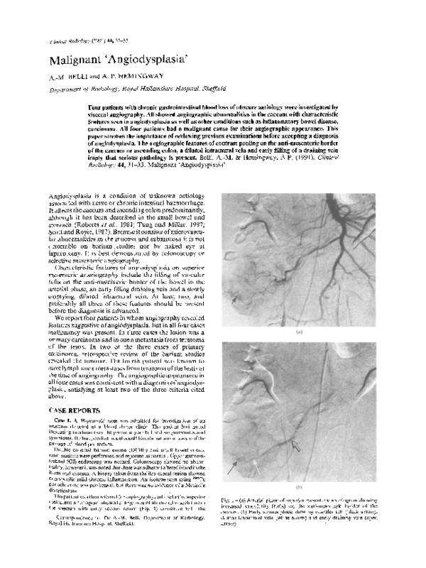 (PDF) Malignant ‘angiodysplasia’