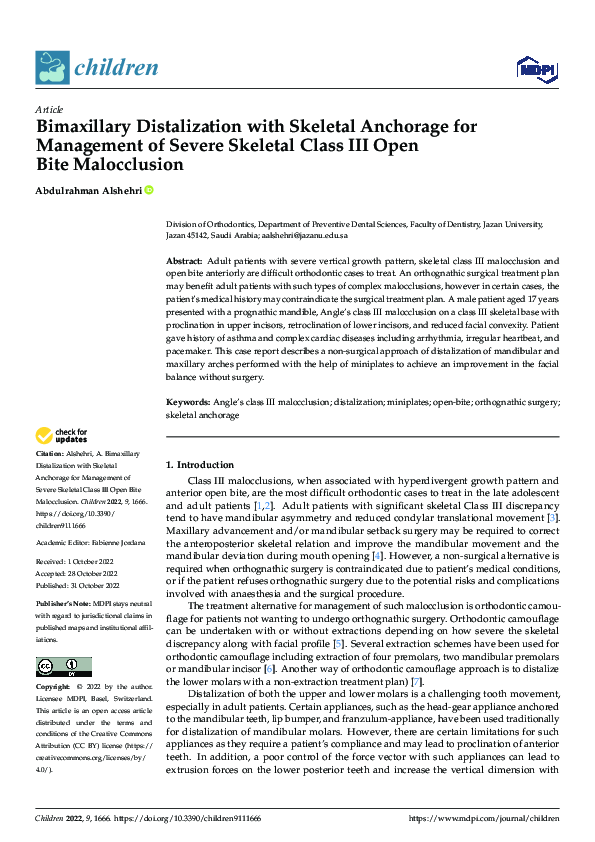 (PDF) Bimaxillary Distalization with Skeletal Anchorage for Management ...