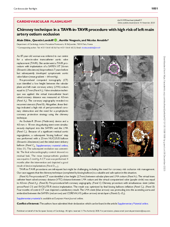 (PDF) Chimney technique in a TAVR-in-TAVR procedure with high risk of ...