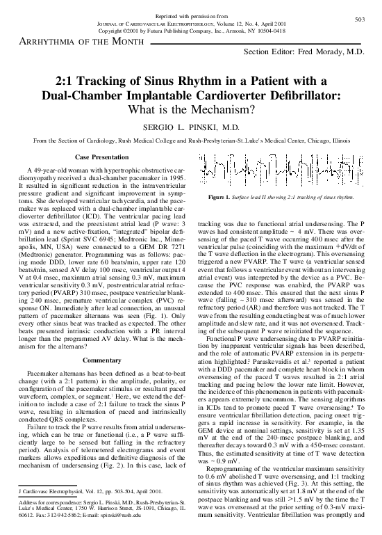 (PDF) 2:1 Tracking of Sinus Rhythm in a Patient with a Dual‐Chamber ...