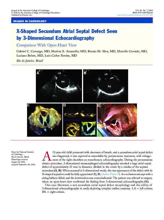 (PDF) X-Shaped Secundum Atrial Septal Defect Seen by 3-Dimensional ...