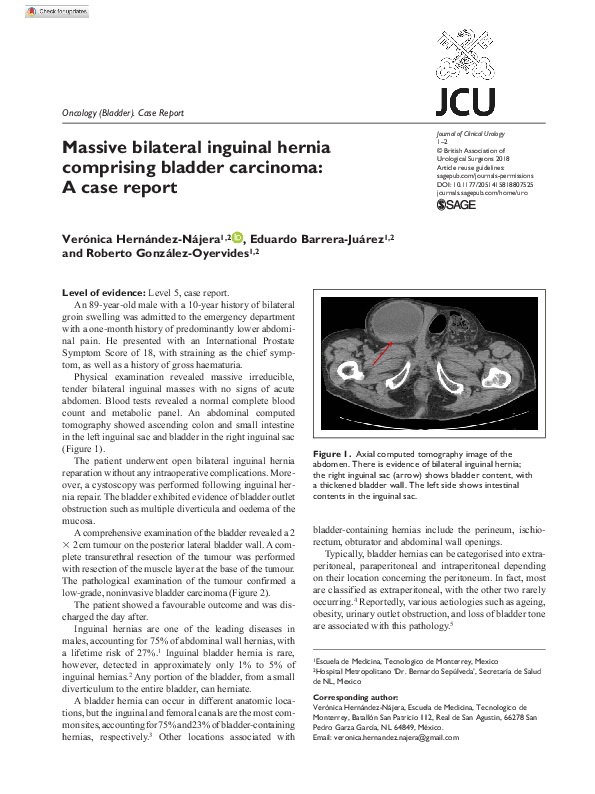 (PDF) Massive bilateral inguinal hernia comprising bladder carcinoma: A ...