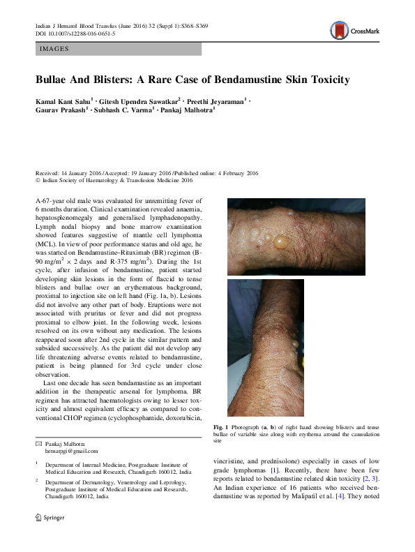 (PDF) Bullae And Blisters: A Rare Case of Bendamustine Skin Toxicity