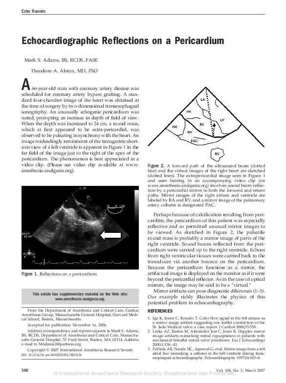 (PDF) Echocardiographic Reflections on a Pericardium | Theodore Alston ...