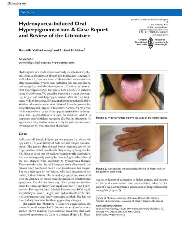 (PDF) Hydroxyurea-Induced Oral Hyperpigmentation: A Case Report and ...