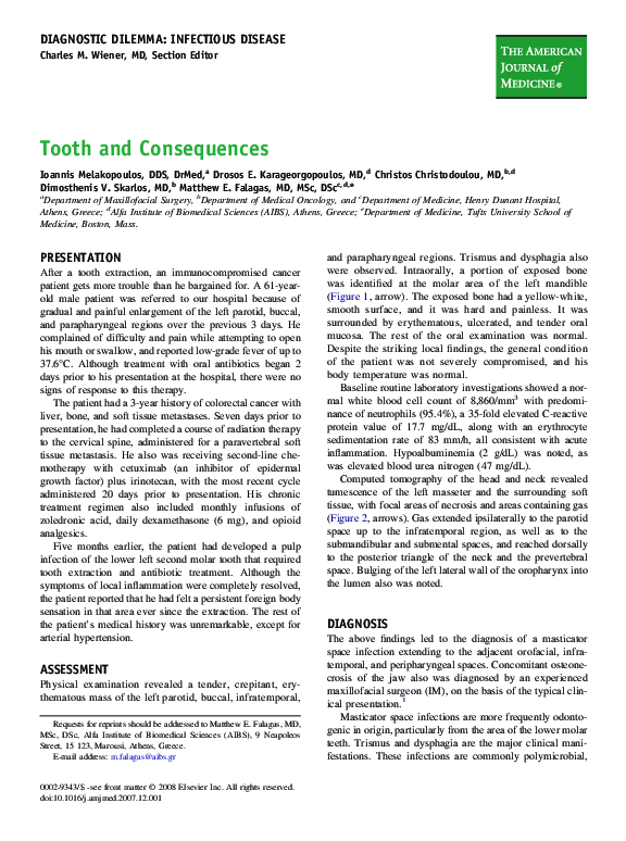 (PDF) Tooth and Consequences