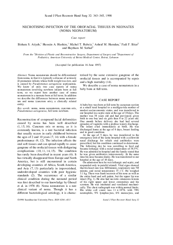 (PDF) Necrotising Infection of the Orofacial Tissues in Neonates (Noma ...