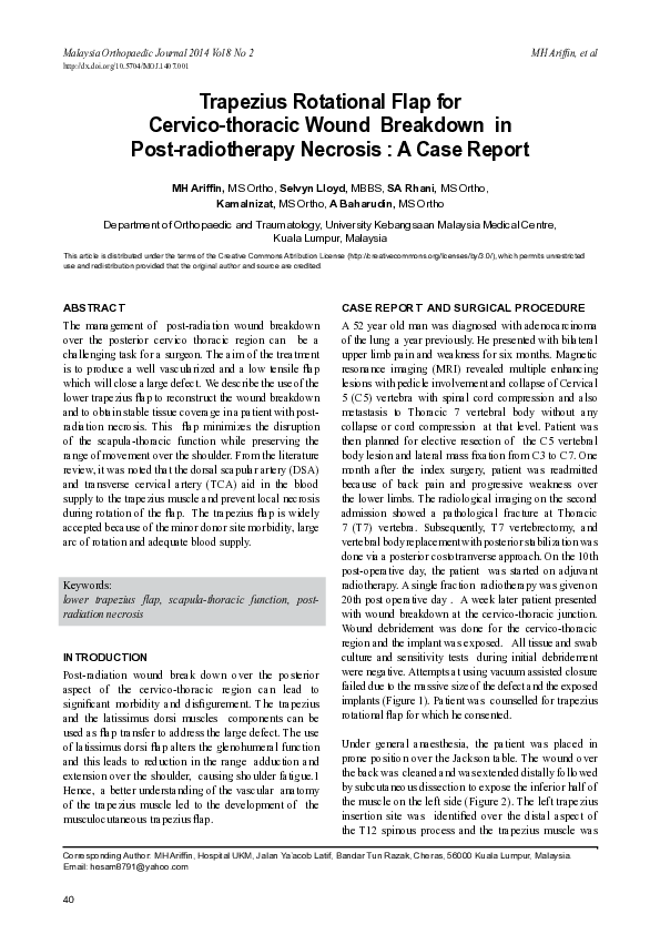 (PDF) Trapezius Rotational Flap for Cervico-thoracic Wound Breakdown in ...
