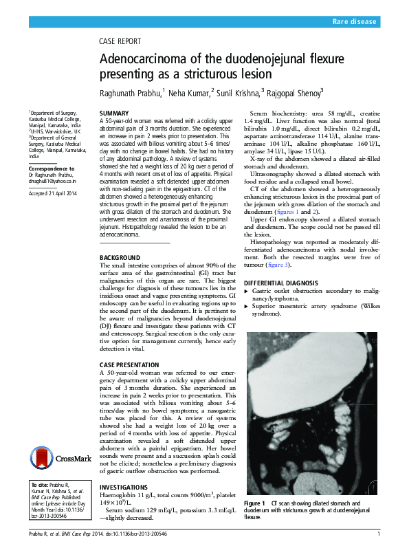 (PDF) Adenocarcinoma of the duodenojejunal flexure presenting as a ...