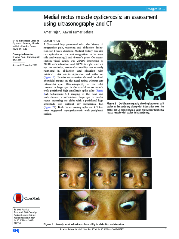 (PDF) Medial rectus muscle cysticercosis: an assessment using ...