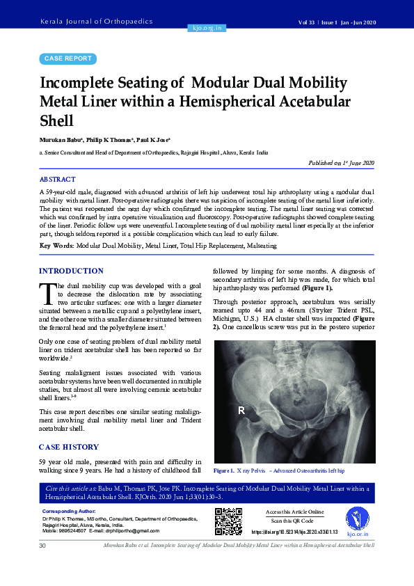 (PDF) Incomplete Seating of Modular Dual Mobility Metal Liner within a ...
