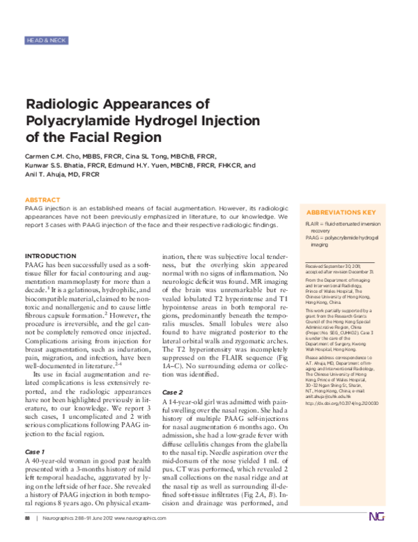 (PDF) Radiologic Appearances of Polyacrylamide Hydrogel Injection of ...