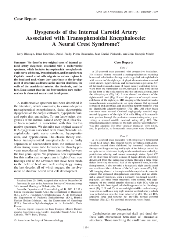 (PDF) Dysgenesis of the internal carotid artery associated with ...