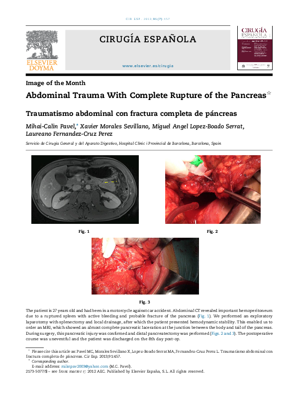 (PDF) Abdominal Trauma With Complete Rupture of the Pancreas