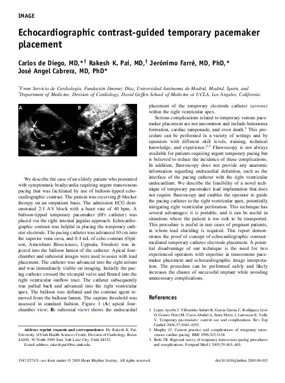 (PDF) Echocardiographic contrast-guided temporary pacemaker placement