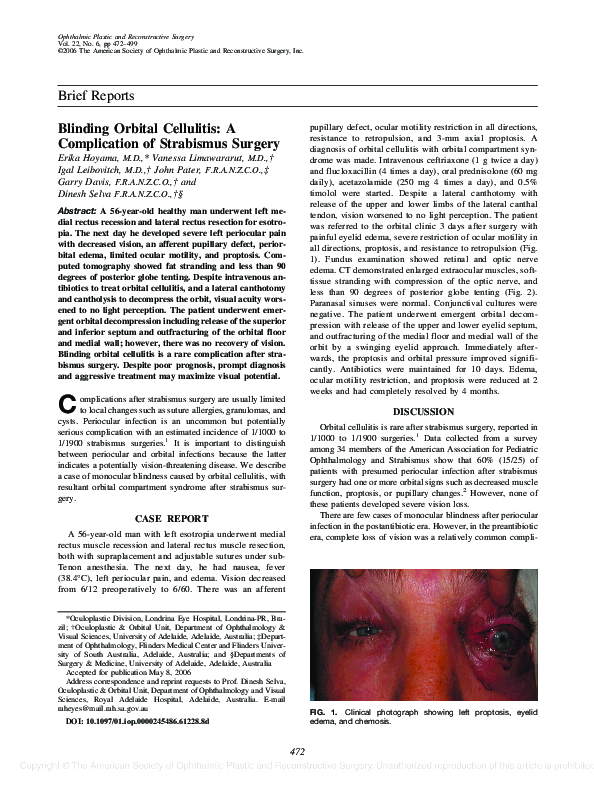 (PDF) Eyelid Switch Flap Technique for the Management of Congenital ...