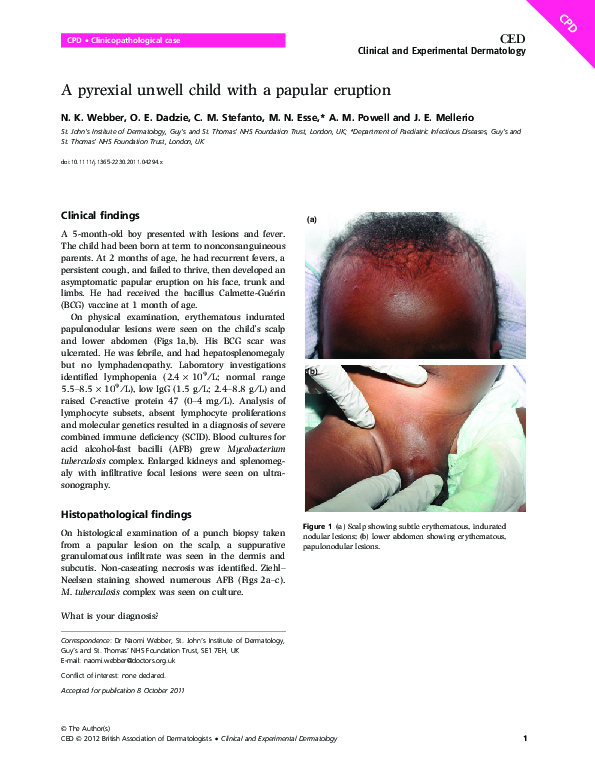 (PDF) A pyrexial unwell child with a papular eruption