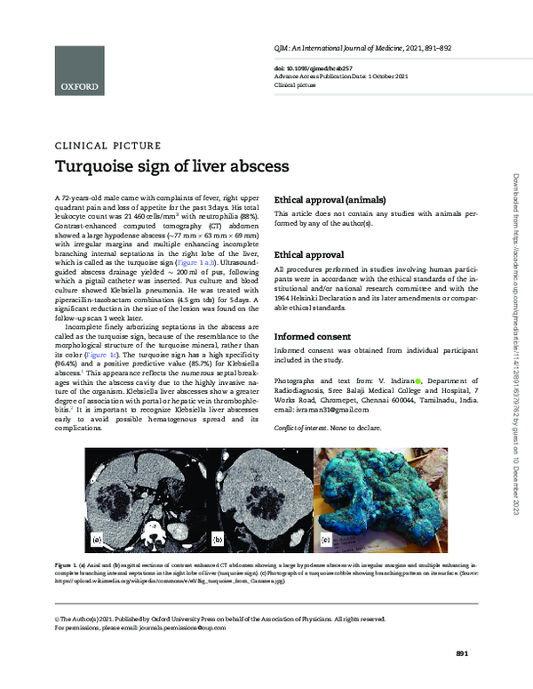 (PDF) Turquoise sign of liver abscess