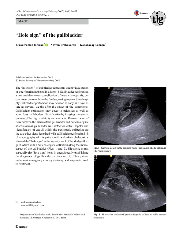 (PDF) “Hole sign” of the gallbladder
