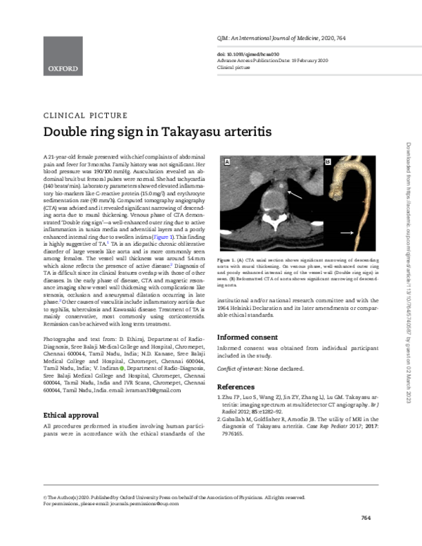(PDF) Double ring sign in Takayasu arteritis