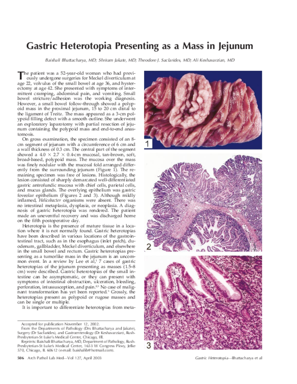 (PDF) Gastric heterotopia presenting as a mass in jejunum