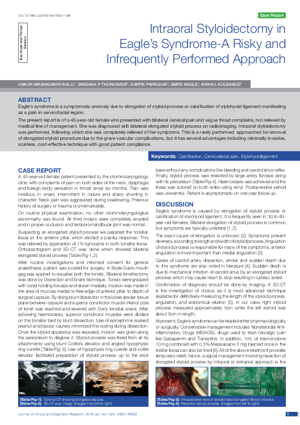 (PDF) Intraoral Styloidectomy in Eagle’s Syndrome-A Risky and ...