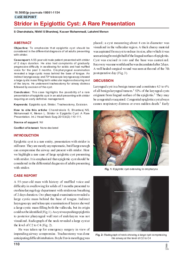 (PDF) Epiglottic Cyst as a Cause of Stridor in Adults