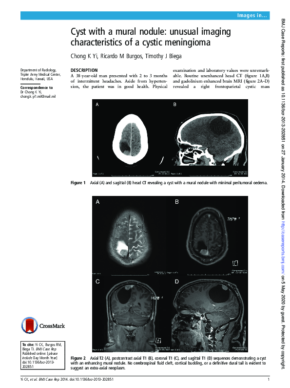 (PDF) Cyst with a mural nodule: unusual imaging characteristics of a ...