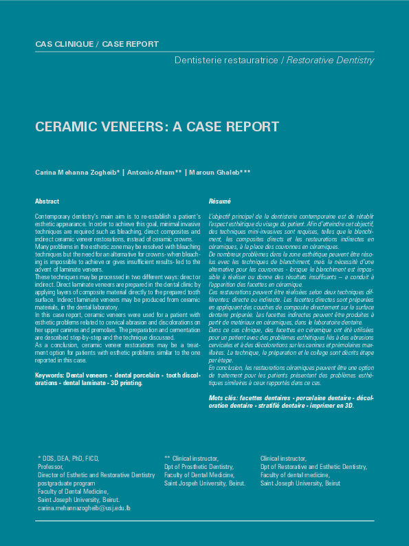 (PDF) Ceramic Veneers : A Case Report