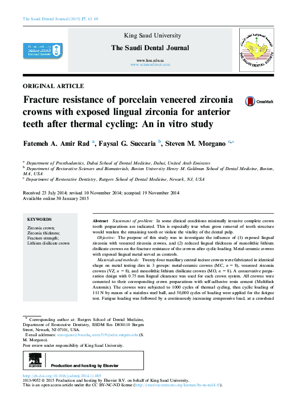 (PDF) Fracture resistance of porcelain veneered zirconia crowns with ...