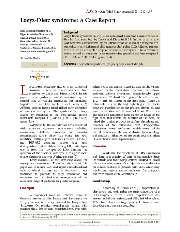 (PDF) Loeys-Dietz syndrome: A Case Report