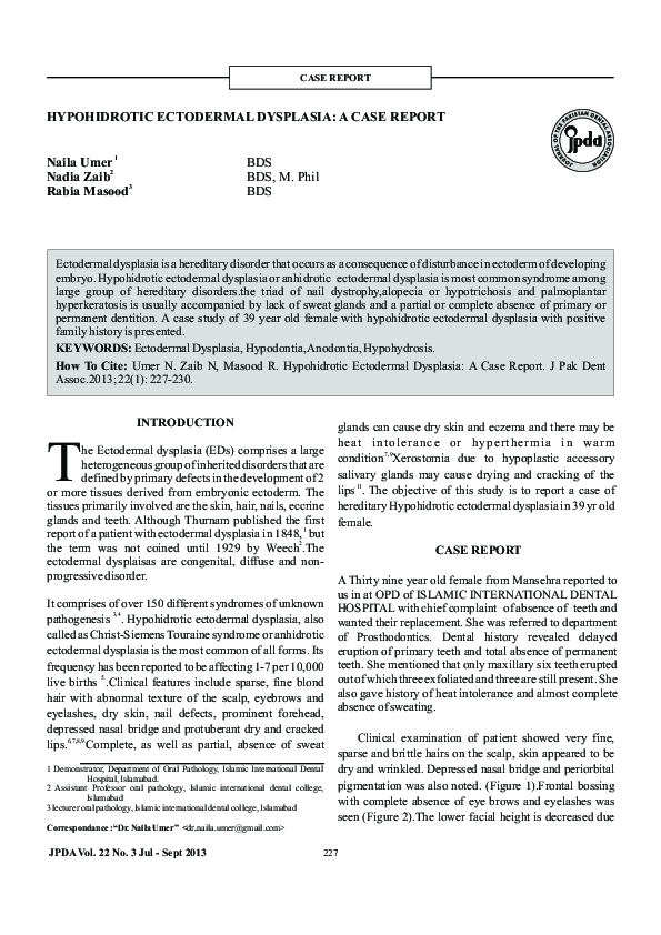 Pdf Hypohidrotic Ectodermal Dysplasia A Case Report