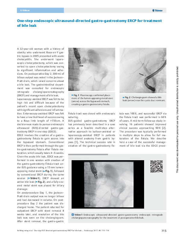 (PDF) One-step endoscopic ultrasound-directed gastro-gastrostomy ERCP ...