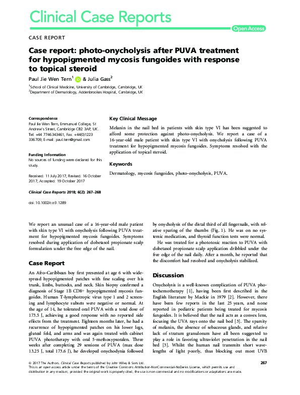(PDF) Case report: photo‐onycholysis after PUVA treatment for ...
