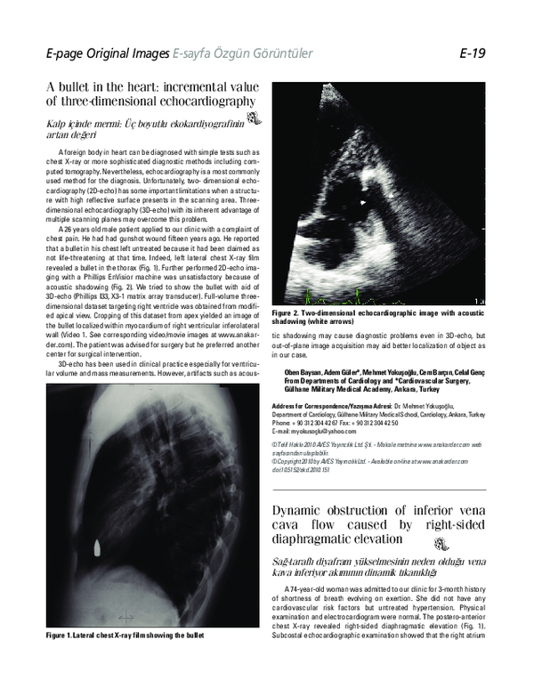 (PDF) Dynamic obstruction of inferior vena cava flow caused by right ...