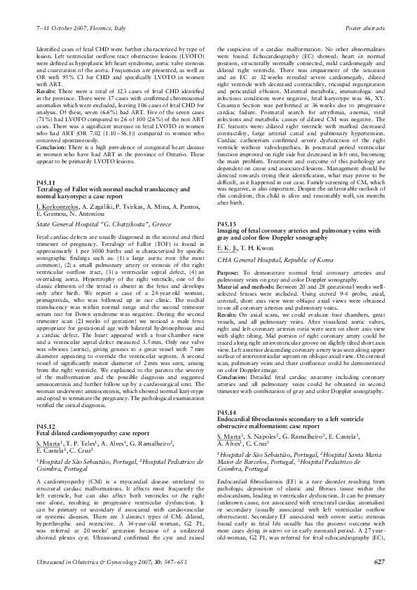 (PDF) P45.11: Tetralogy of Fallot with normal nuchal translucency and normal karyotype: a case ...