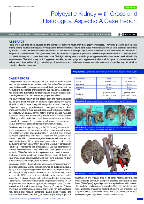 (PDF) Polycystic Kidney with Gross and Histological Aspects: A Case Report