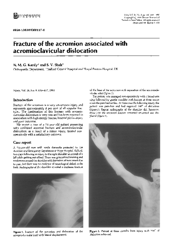 (PDF) Fracture of the acromion associated with acromioclavicular ...