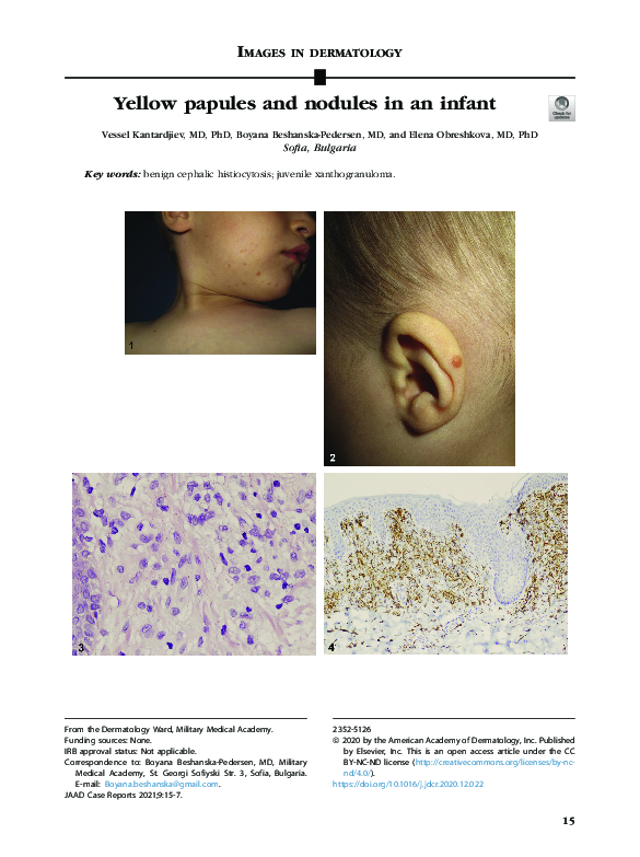 (PDF) Yellow papules and nodules in an infant